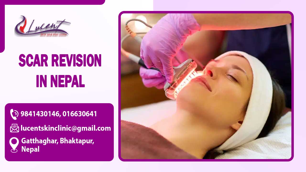 Get rid of hestitation marks? Best Scar revision in Nepal