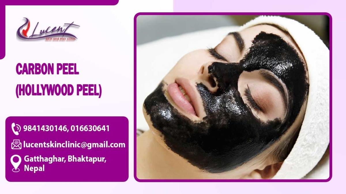 Carbon Peeling in Nepal | Hollywood Carbon Peel Treatment