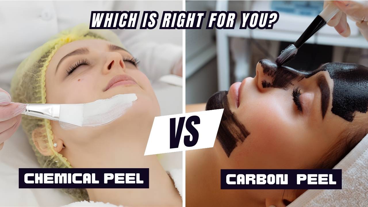 Carbon Peel vs Chemical Peel: Safety, Risks & Skin Suitability